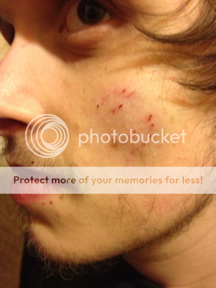 Wacked by a scrub python! | Reptile Forums